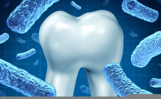 Halitosis: Bacteria Types That Cause the Smell | Affordable Dentist ...